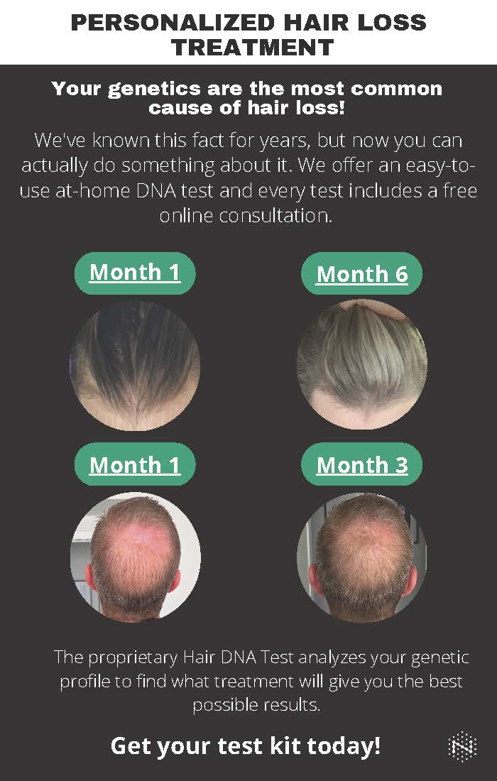 Nimbus Hair DNA Test – Remedy Holistic